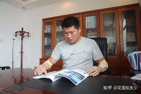 手指截肢后的康复训练有哪些 知乎