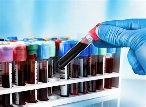 Barcodes For Accurate Lab Specimen Labels Scanbot Sdk