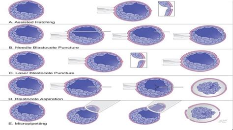 An Overview On Embryos Cryopreservation And Vitrification Pdf