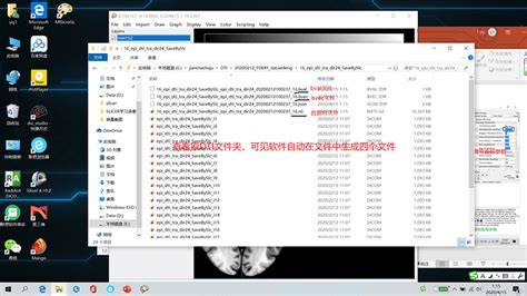 联影磁共振dti数据导入 经验分享 3dslicer中文论坛