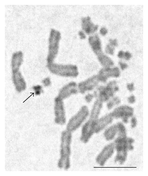 Repetitive Sequence And Sex Chromosome Evolution In Vertebrates Ezaz