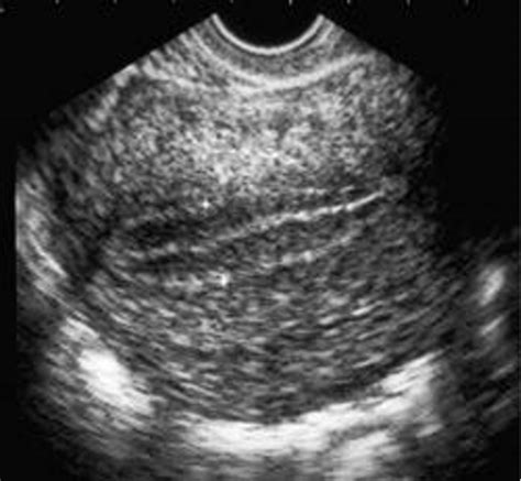 Pelvic Quiz Flashcards Quizlet