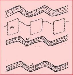 Echo Unit 2 Test Flashcards Quizlet