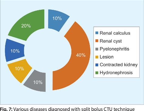 Figure 2 From Triphasic Single Bolus And Biphasic Split Bolus Techniques In Computed Tomography