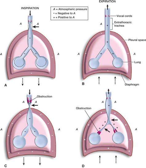 The Pediatric Airway Clinical Tree