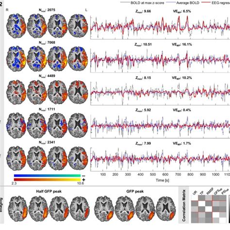 Extraction Of Eeg Synchronization Metrics Illustrative Example For