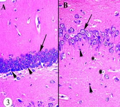 A The Granular Cell Layer Containing Granular Cells With Vesicular Download Scientific