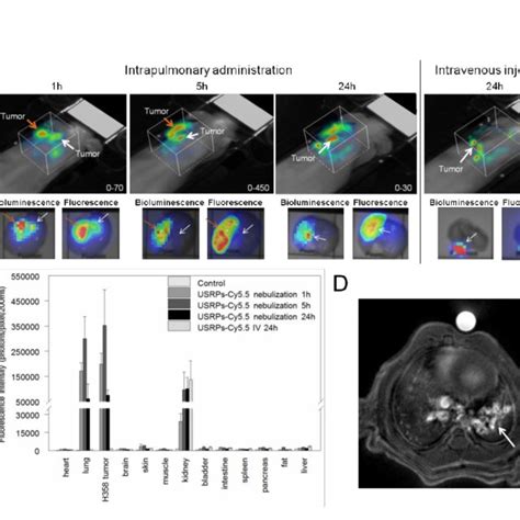7 Schematic Representation Of Asthma Pathophysiology Several
