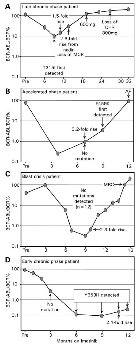 Serial Measurement Of Bcr Abl Transcript Levels In Patients With A Rise In Download Scientific