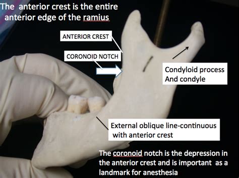 Coronoid Notch