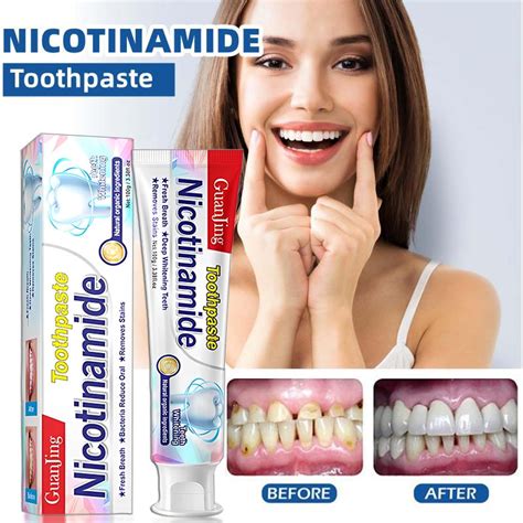 Nicotinamide Toothpaste Gum Care Mint Toothpasteteeth Whitening Remove Tooth Stains Fresh Breath