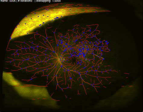 Bees Created Using The Binary Segmented Image Vessel Segments In Red Download Scientific