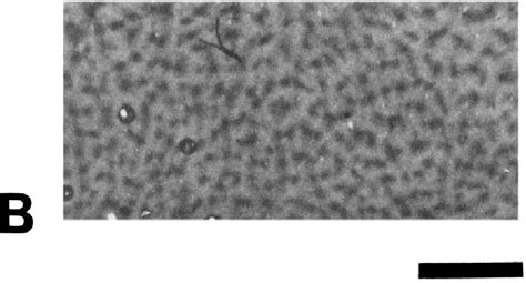Figure 1 From Functional Anatomy Of Macaque Striate Cortex V Spatial