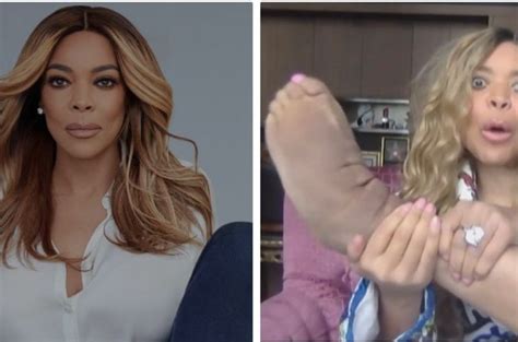 Wendy Williams Reveals How Large Her Feet Are Due To Lymphedema Watch