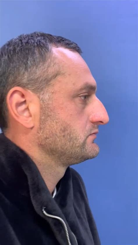 Zurab Kekelia ოცნებების ახდენის მომენტი როცა პაციენტმა სარკეში საკუთარი ახალი სახე პირველად