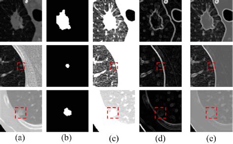 Figure 1 From A Dual Branch Framework With Prior Knowledge For Precise Segmentation Of Lung