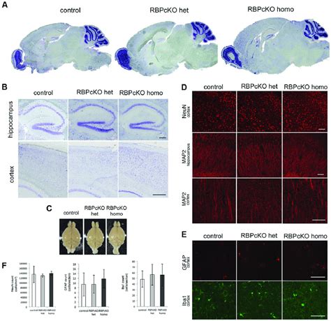 Normal Brain Morphology In Rbpcko Mice At Over 12 Months Of Age A Download Scientific