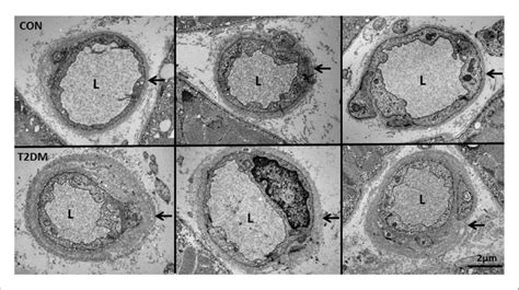 Capillary Basement Membrane And Extracellular Space Arrows Indicate