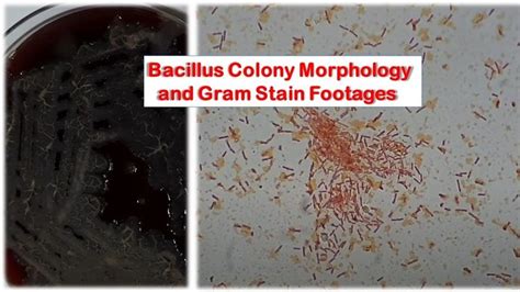 Bacillus Colony Morphology And Its Gram Stain