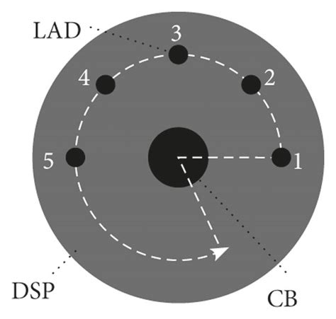 Schematic Diagram Of The Seismic Isolation Device A Lateral View Download Scientific