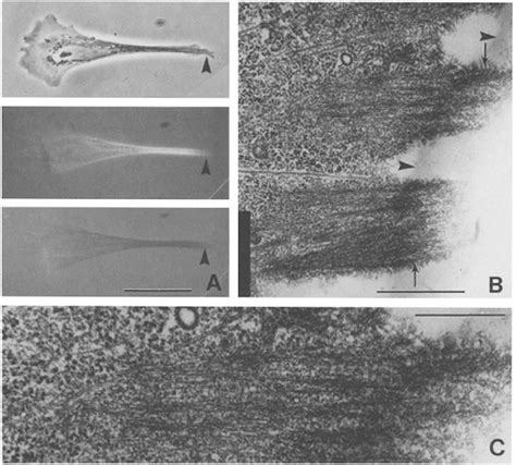 A Correlation Of Light Microscopy And Electron Microscopy Of The