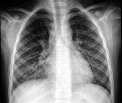 Graduation Project 2023 Roboflow Universe