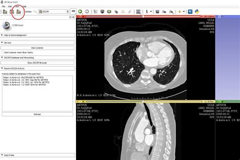how to create an nrrd file from a dicom medical imaging data set 3d