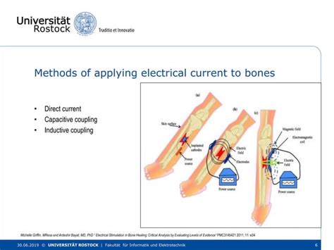 Modeling And Simulation Of Bone Healing Through Electrical Stimulation Ppt