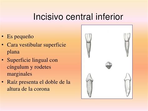 Anatomía Dientes Temporales