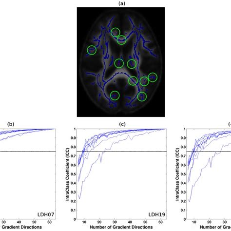 The Effect Of Diffusion Weighted Gradient Direction Number On The Download Scientific Diagram