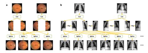 【医学图像数据增强】切割 拼接cs Da医学影像分割 切片合并 Csdn博客