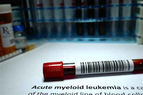 Aacr News Human Acute Myeloid Leukemia Reportedly Closely Mimicked For First Time By