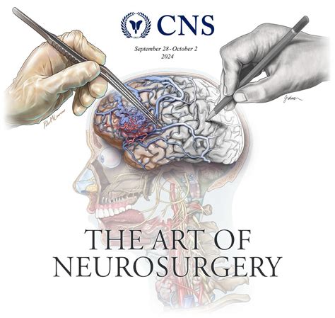 excited to announce the art of neurosurgery 2024 program at cns update this year we will be
