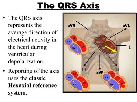 4 Ecg Basics Rate And Axis Ppt
