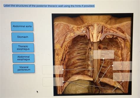 Solved Label The Structures Of The Posterior Thoracic Wall