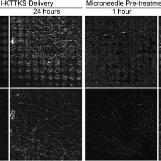 LSCM Images Of Rigin Delivery Into Excised Human Skin Representative Download Scientific
