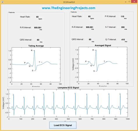 tag ecg averaging in matlab the engineering projects