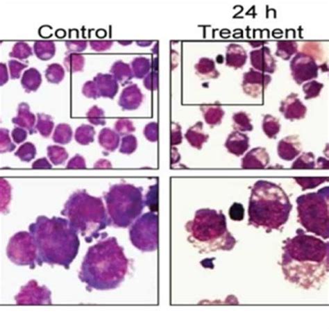 Live Dead Cells Under The Influence Of Trypan Blue Download