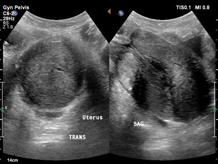 Radiology Quiz Radiopaedia Org