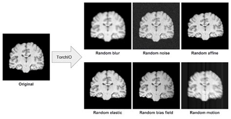 An Example Of 3d T1 Weighted Mri Data Augmentation Results In The Download Scientific Diagram
