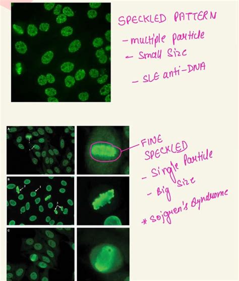 Sle Immunofluorescence Medizzy