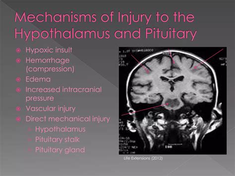 Neuroendocrine Dysfunction Following Traumatic Brain Injury Pptx