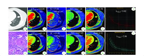 Dual Energy Spectral Ct Images And Pathological Sections Of A Download Scientific Diagram