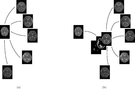 Figure 4 From An Automatic Pipeline For Atlas Based Fetal And Neonatal Brain Segmentation And