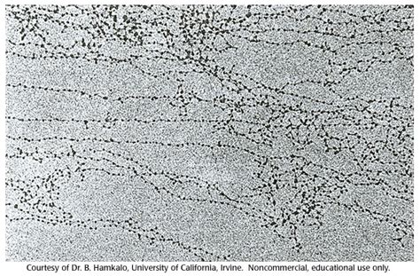 Electron Micrograph Of Chromatin Cshl Dna Learning Center