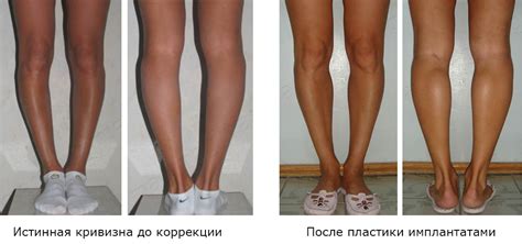 Как изменить форму ног упражнения