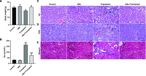 Effect Of Intestinal Flora Imbalance On Renal Transplantation In Mice Download Scientific