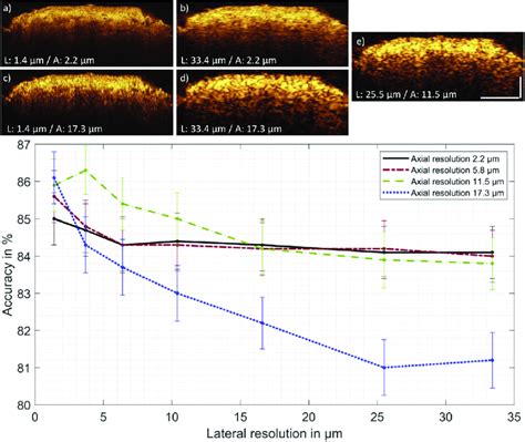 Classification Of OCT Data Of Pituitary And Adenoma Top Five Download Scientific Diagram