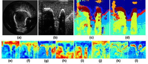 Example Of Ivus Image Classification By M 2 Ssl First Row Ivus Image Download Scientific