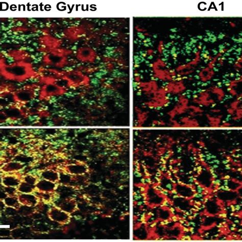 Nmda Receptor Trafficking To Synapses Increases With Se Antibodies To